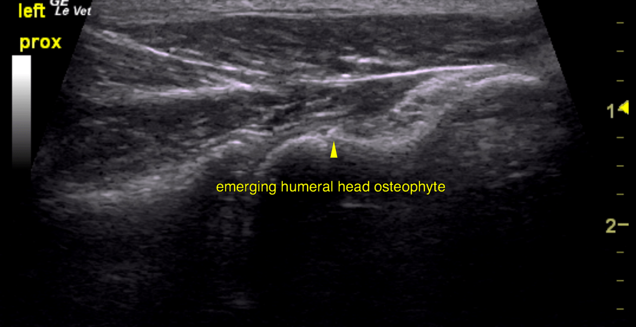 ORTHO - Normal ultrasound of the right and left biceps, infra- and ...