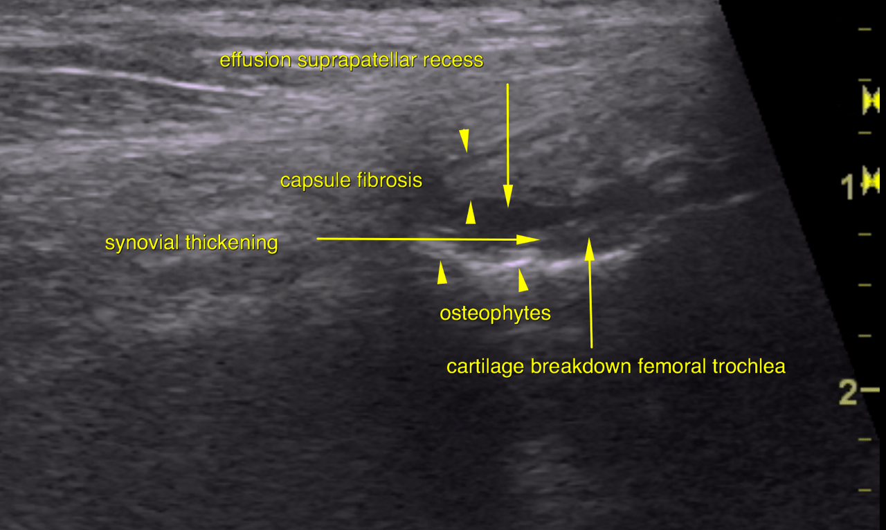 ORTHO - Left and Right Stifle Cranial Cruciate Ligament (CCL) rupture ...