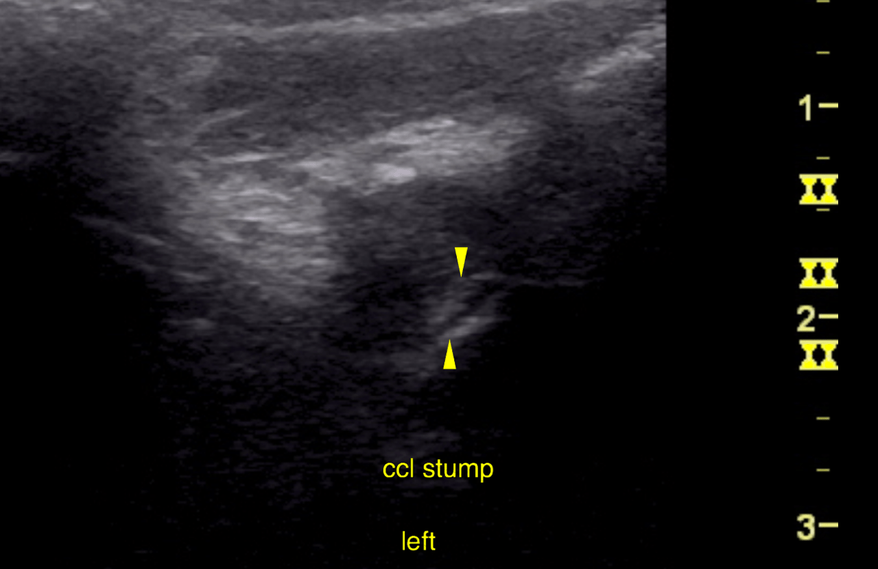 ORTHO - Left and Right Stifle Cranial Cruciate Ligament (CCL) rupture ...