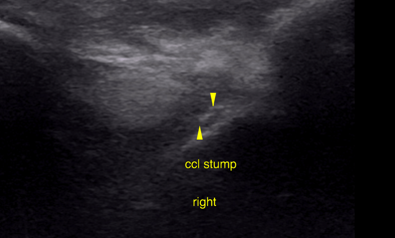 ORTHO - Left and Right Stifle Cranial Cruciate Ligament (CCL) rupture ...