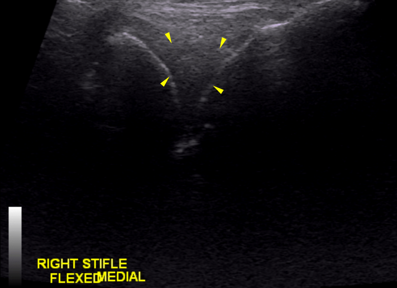 ORTHO - Left and Right Stifle Cranial Cruciate Ligament (CCL) rupture ...