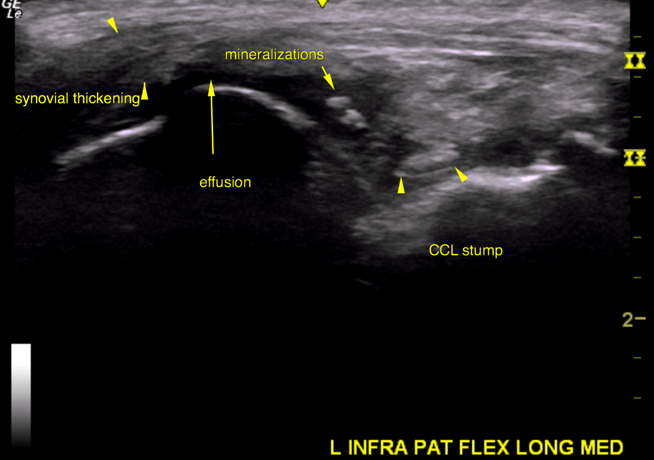 ORTHO - Left stifle cranial cruciate rupture with incomplete meniscal ...