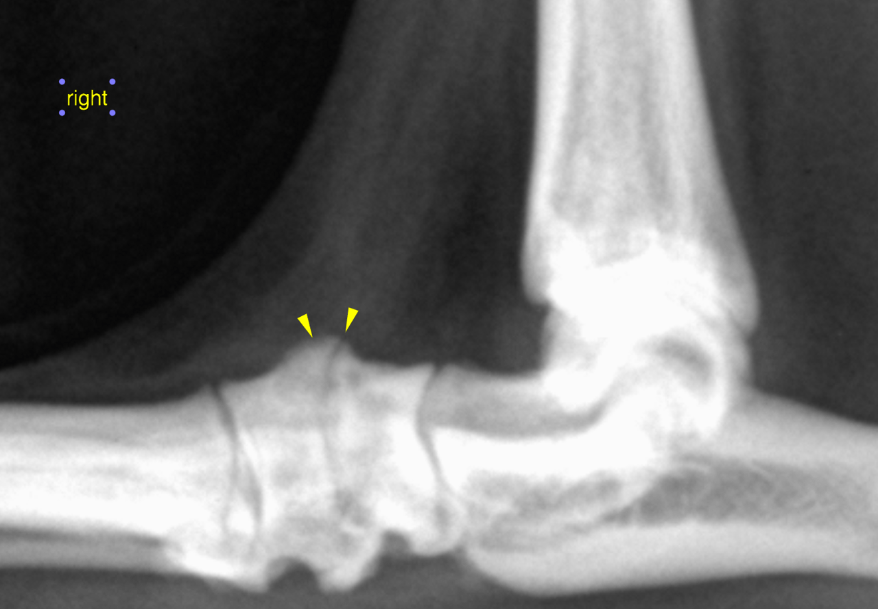RAD - Hip dysplasia, osteoarthritis and disuse atrophy in a 4 year old ...