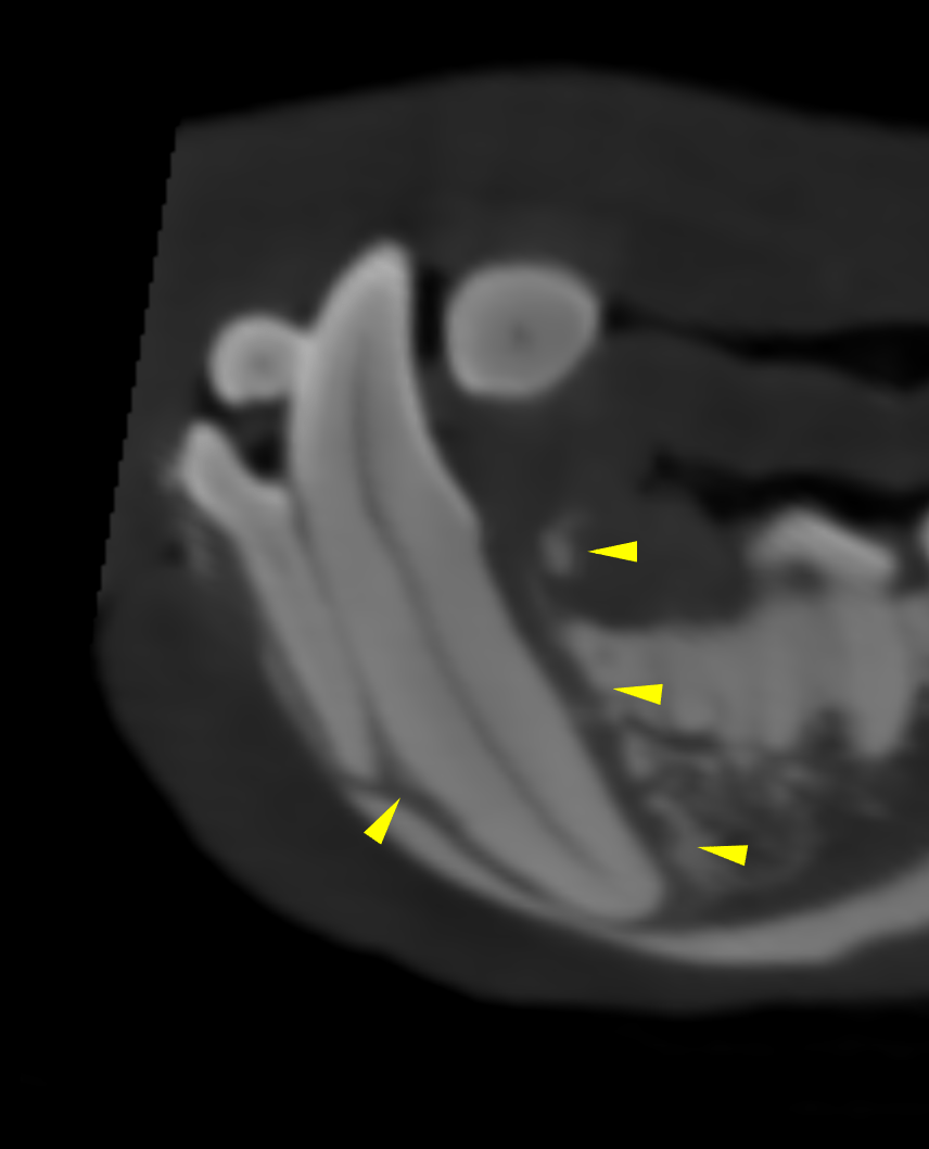 CT - Odontogenic or soft tissue neoplasia at area of canine tooth in a ...