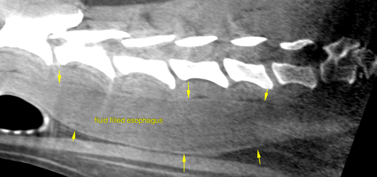 CT - Cervical disc protrusions and mild caudal cervical ...