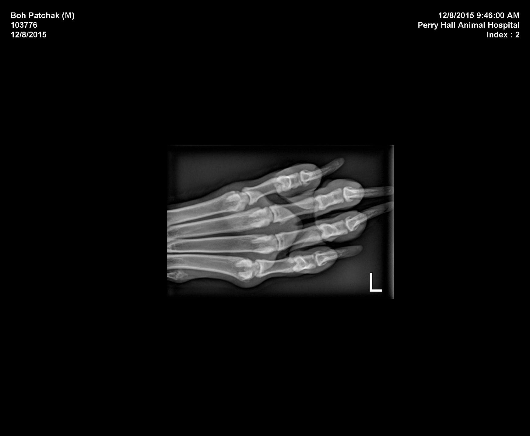 RAD - normal skeletal structures of 5th digit and surrounding ...