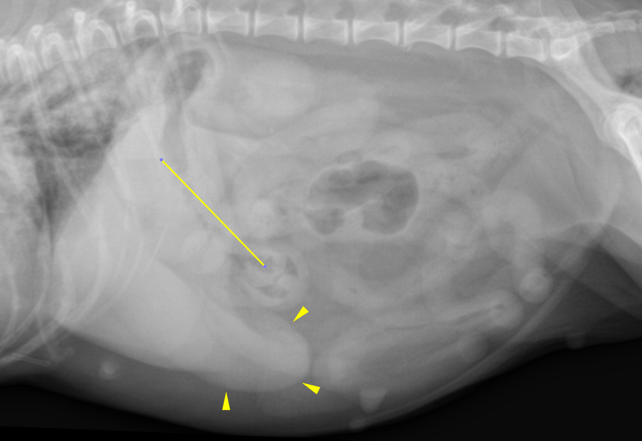 RAD - Left-sided congestive heart failure (CHF) with cardiogenic ...