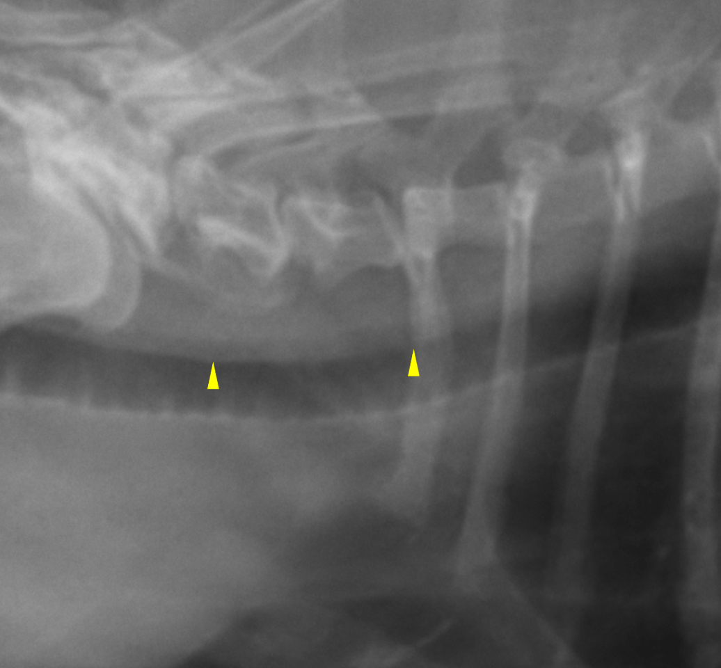 RAD - Left-sided congestive heart failure (CHF) with cardiogenic ...