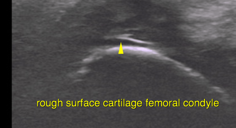 ORTHO -Chronic degenerative joint disease (DJD) with cranial cruciate ...
