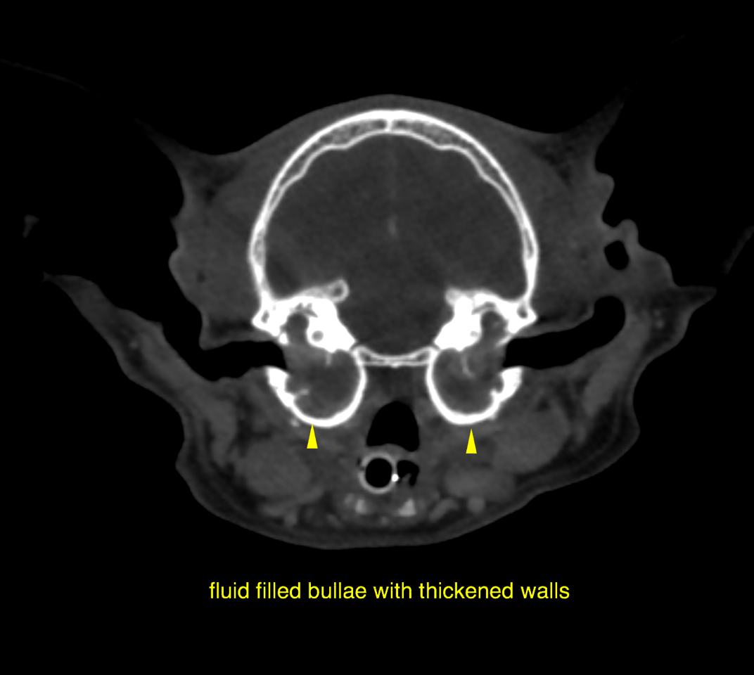 CT - bilateral chronic destructive rhinitis with secondary sinusitis ...