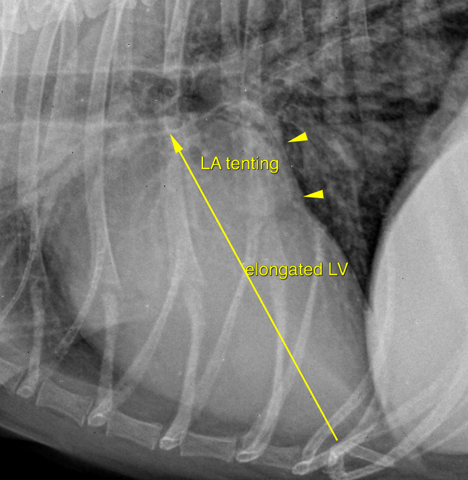 RAD - Mild left-sided cardiomegaly likely from mitral regurgitation ...