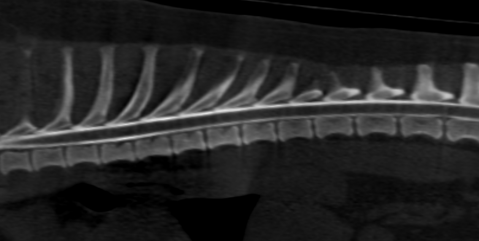 CT - chronic protrusion of the cervical 3/4 disc with mild compressive ...