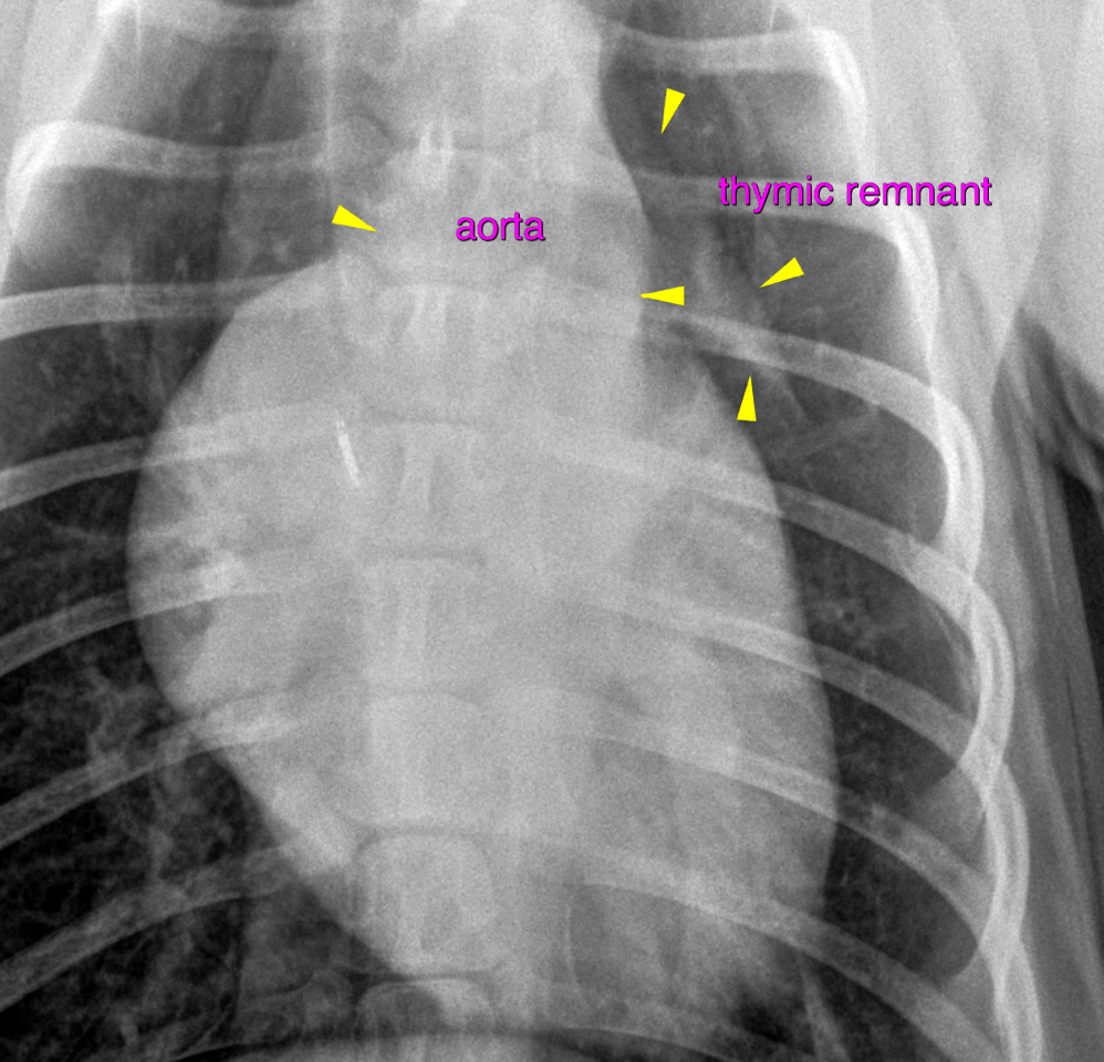 RAD - Normal juvenile thorax in a 6 month old Golden Retriever dog with ...