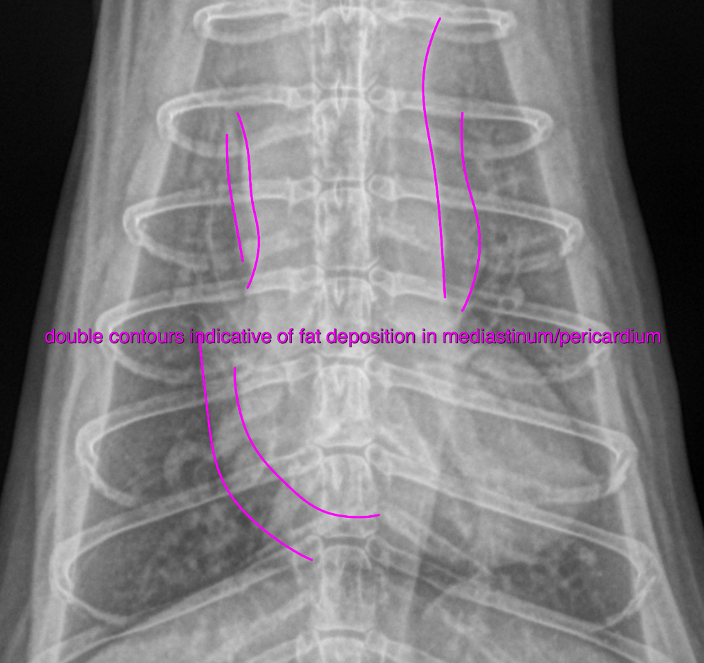 RAD - Multifocal neoplastic infiltrate involving the spleen and lymph ...