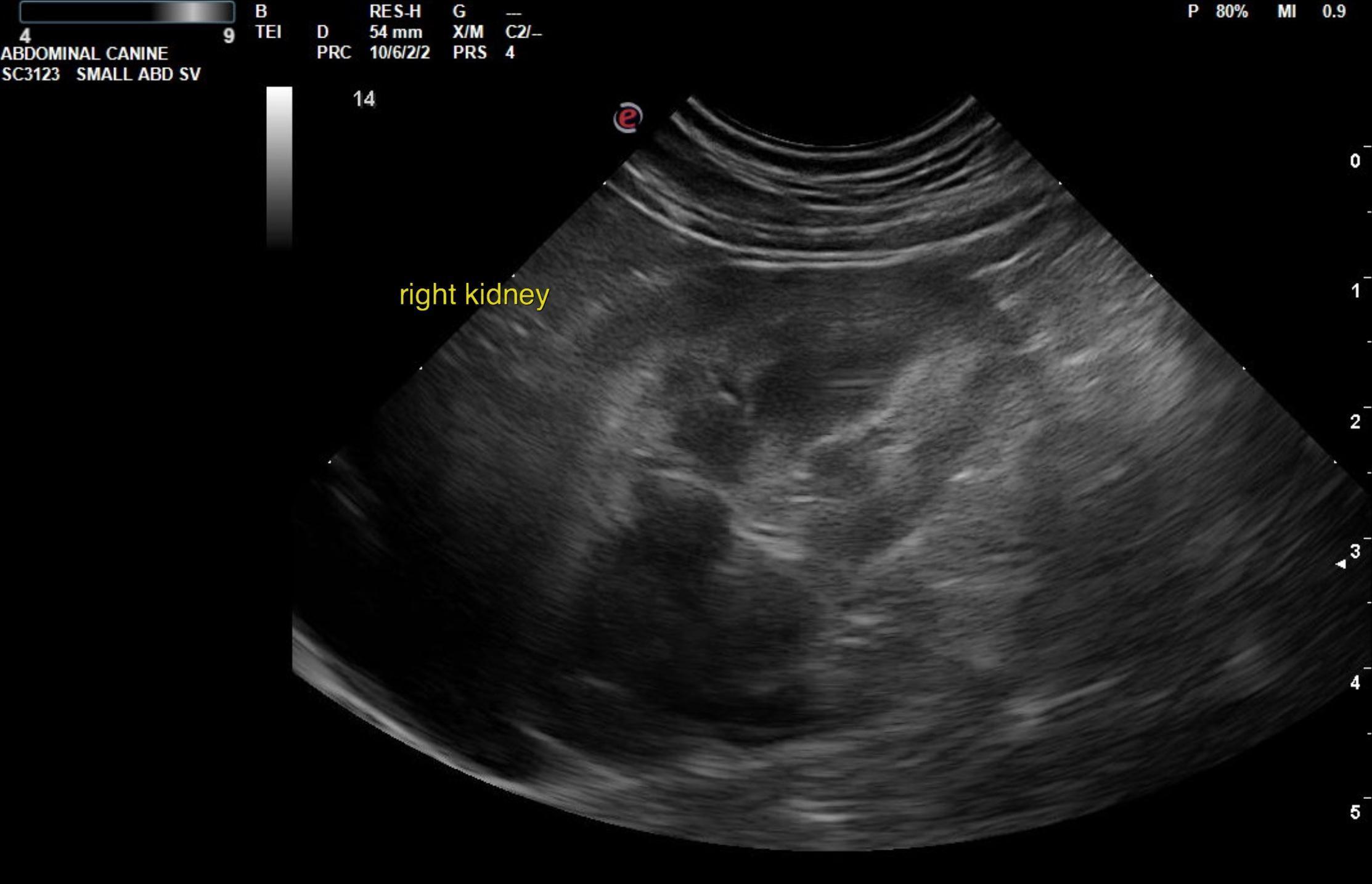 Thickened ventral bladder wall and apex, R/O chronic cystitis, TCC , or ...