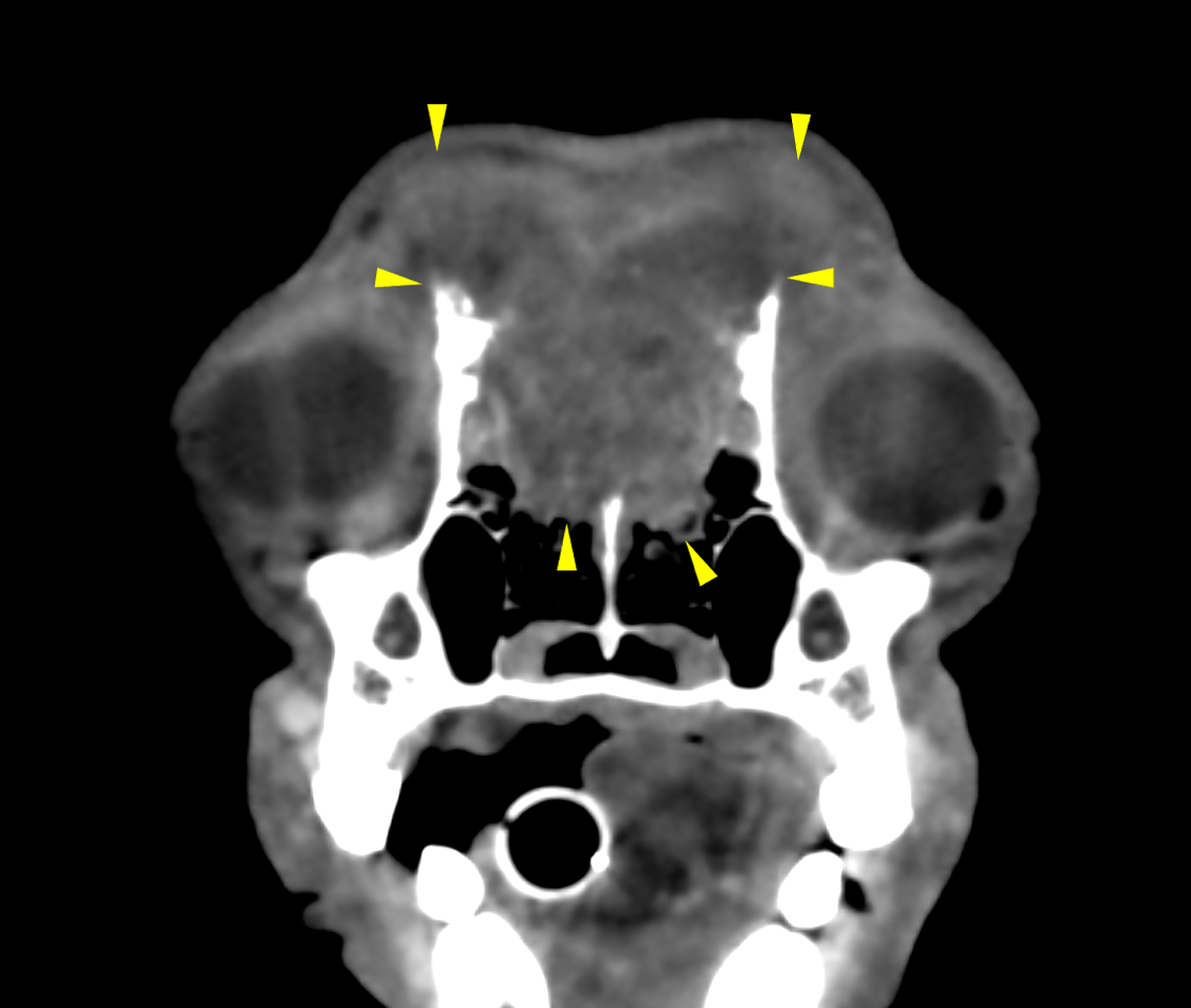 CT - Malignant sinus neoplasia with extensive bone destruction in a 8 ...