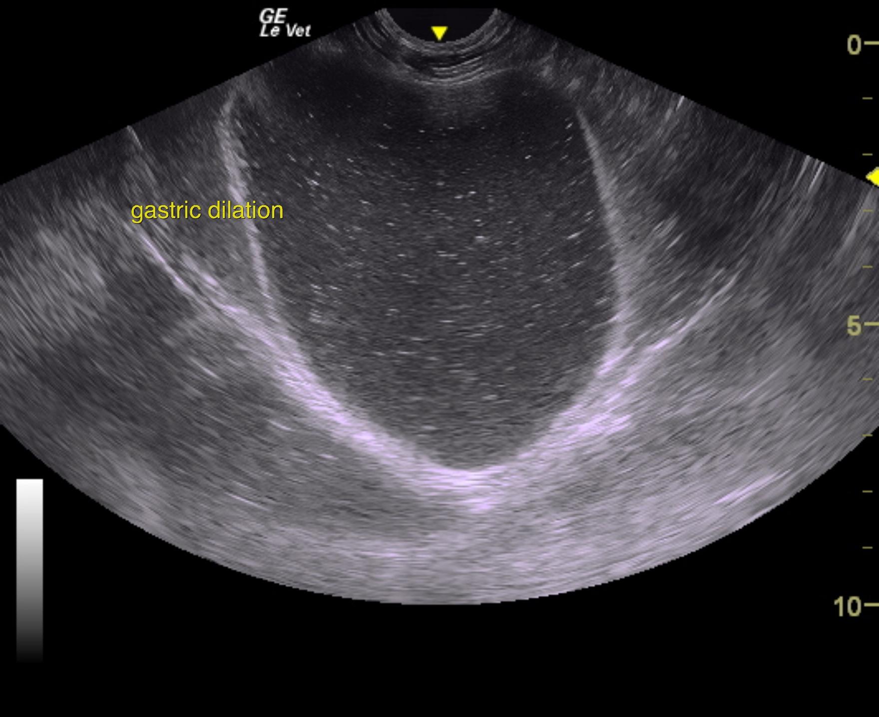 Pyloric duodenal foreign body obstruction with severe gastric stasis in ...