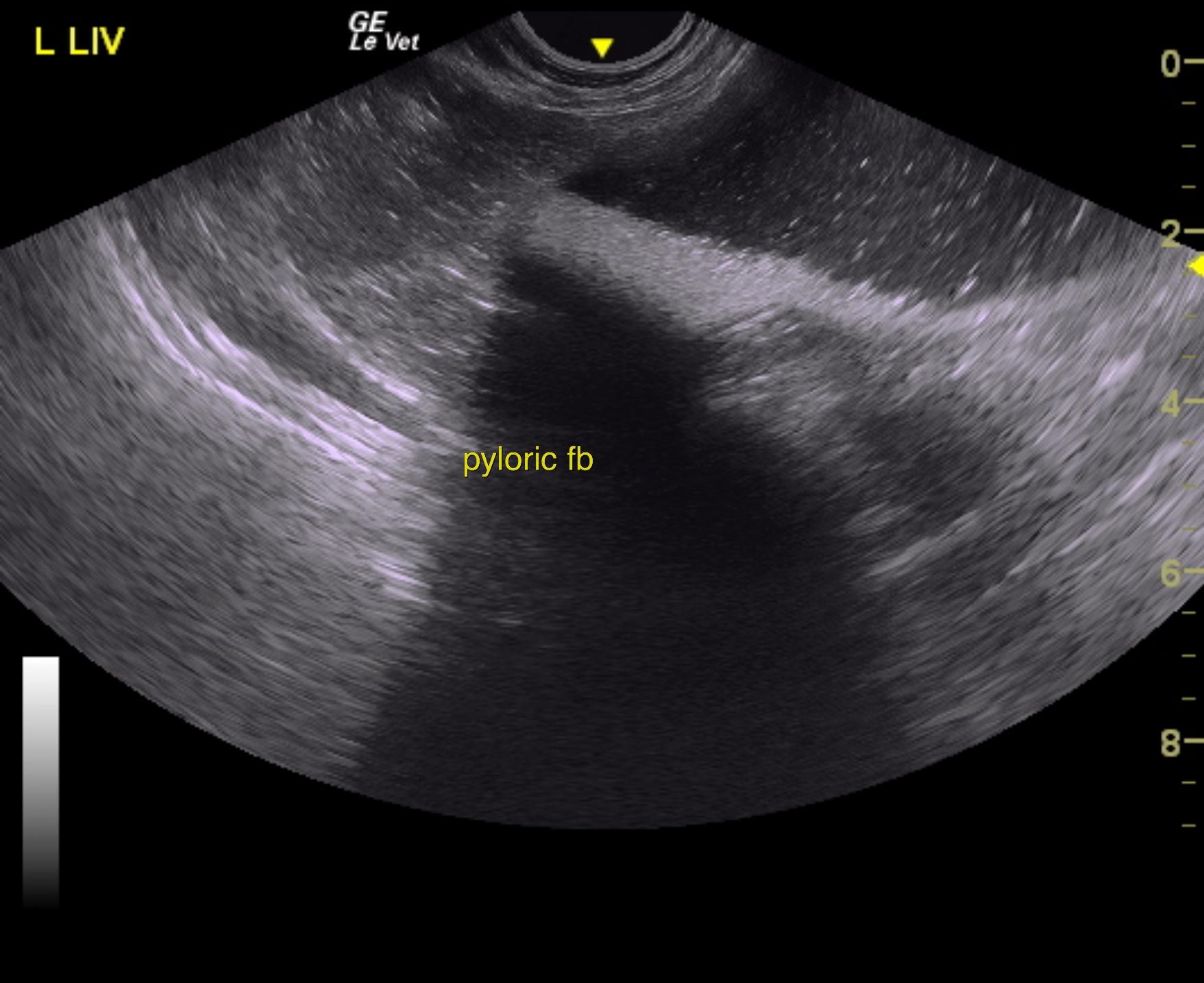 Pyloric duodenal foreign body obstruction with severe gastric stasis in ...