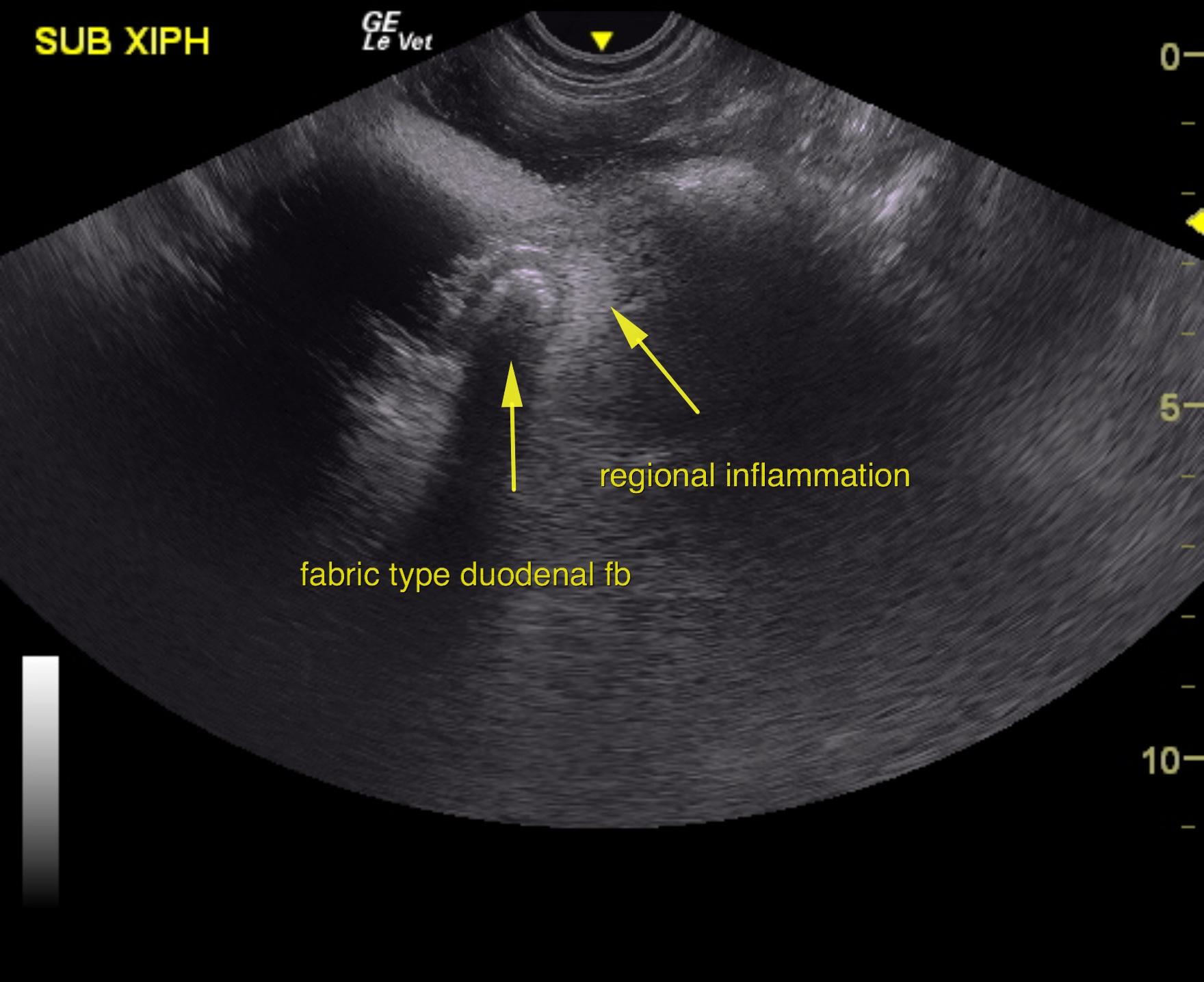 Pyloric duodenal foreign body obstruction with severe gastric stasis in ...