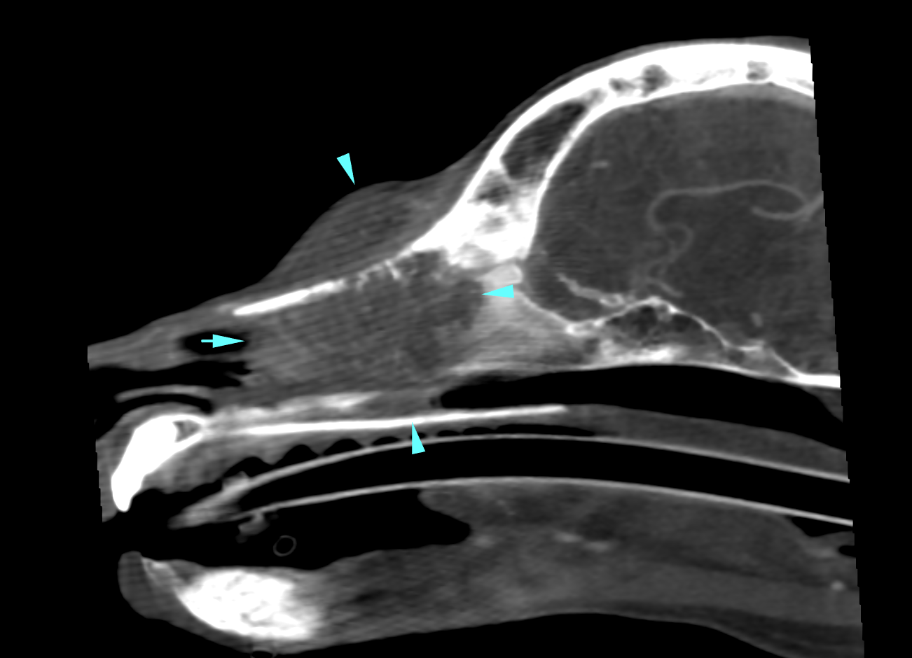 CT - Expansile nasal soft tissue mass with osteolysis, rhinitis and ...