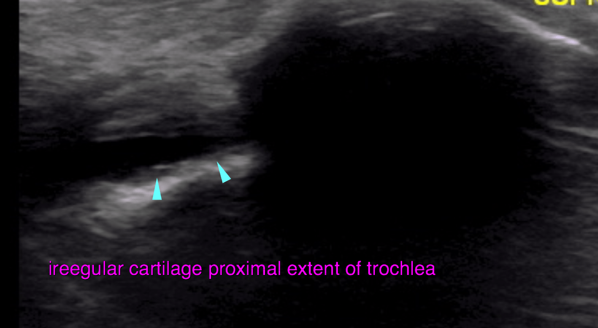 ORTHO Cranial Cruciate Ligament CCL Rupture Post surgical Repair In