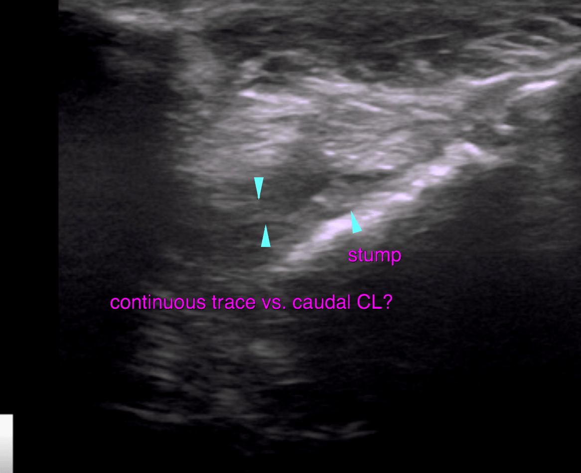 ORTHO Cranial Cruciate Ligament CCL Rupture Post surgical Repair In