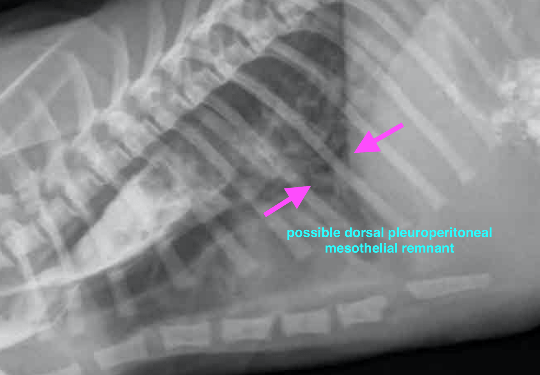 RAD - Megaesophagus, congenital vascular ring anomaly and aspiration ...