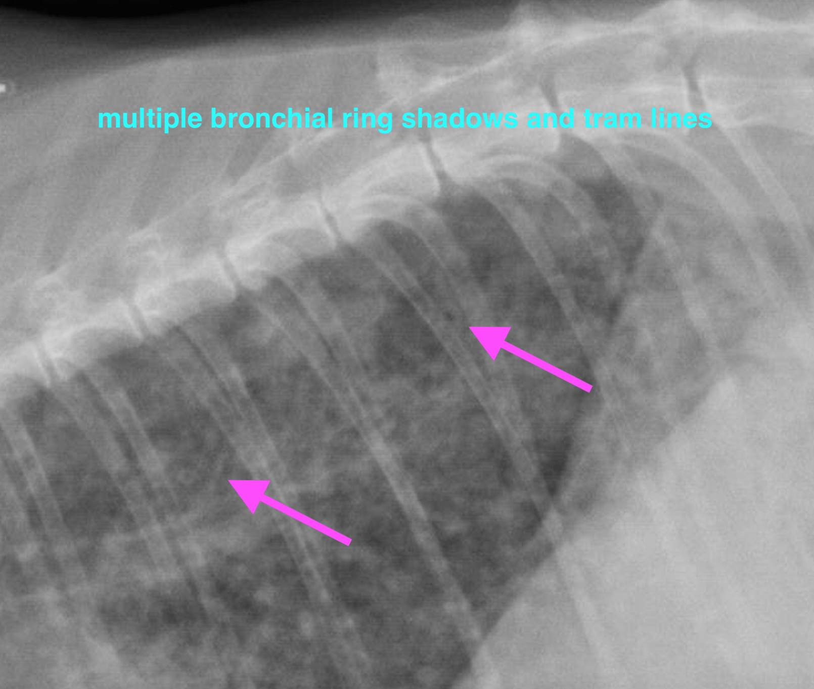RAD - Severe active bronchitis in a 11 year old FS DSH cat - Members