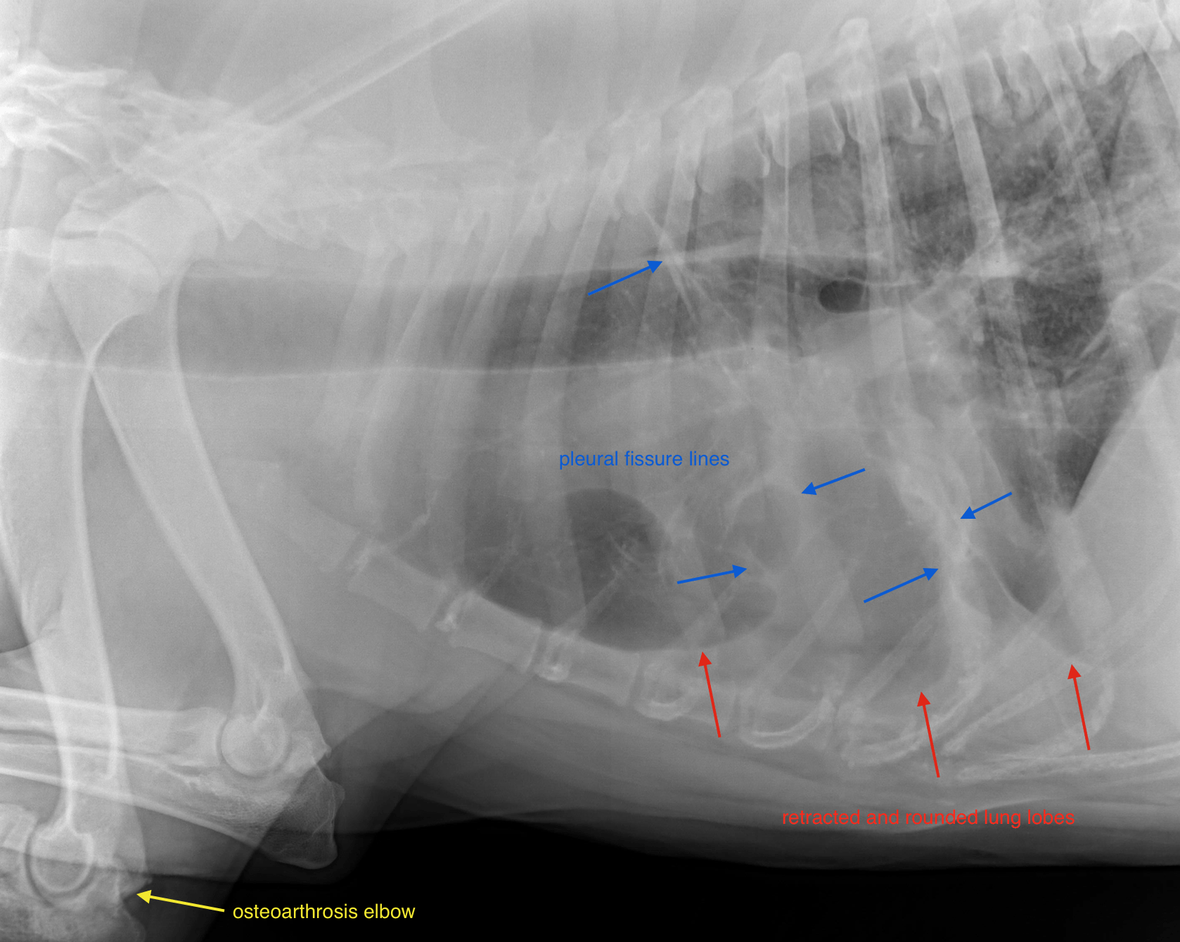 RAD -Splenic mass lesion with lobar alveolar infiltrate in a 7 year old ...