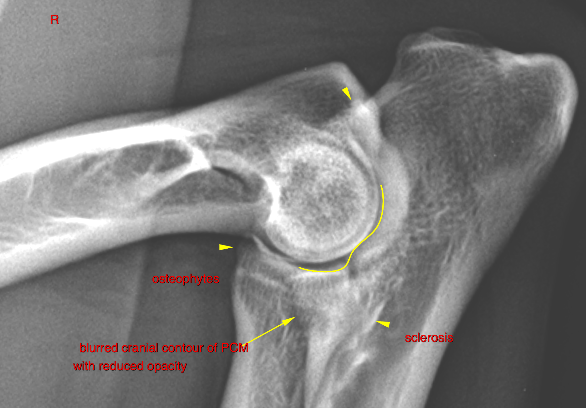 RAD - Bilateral elbow dysplasia with medial coronoid pathology in a 3 ...