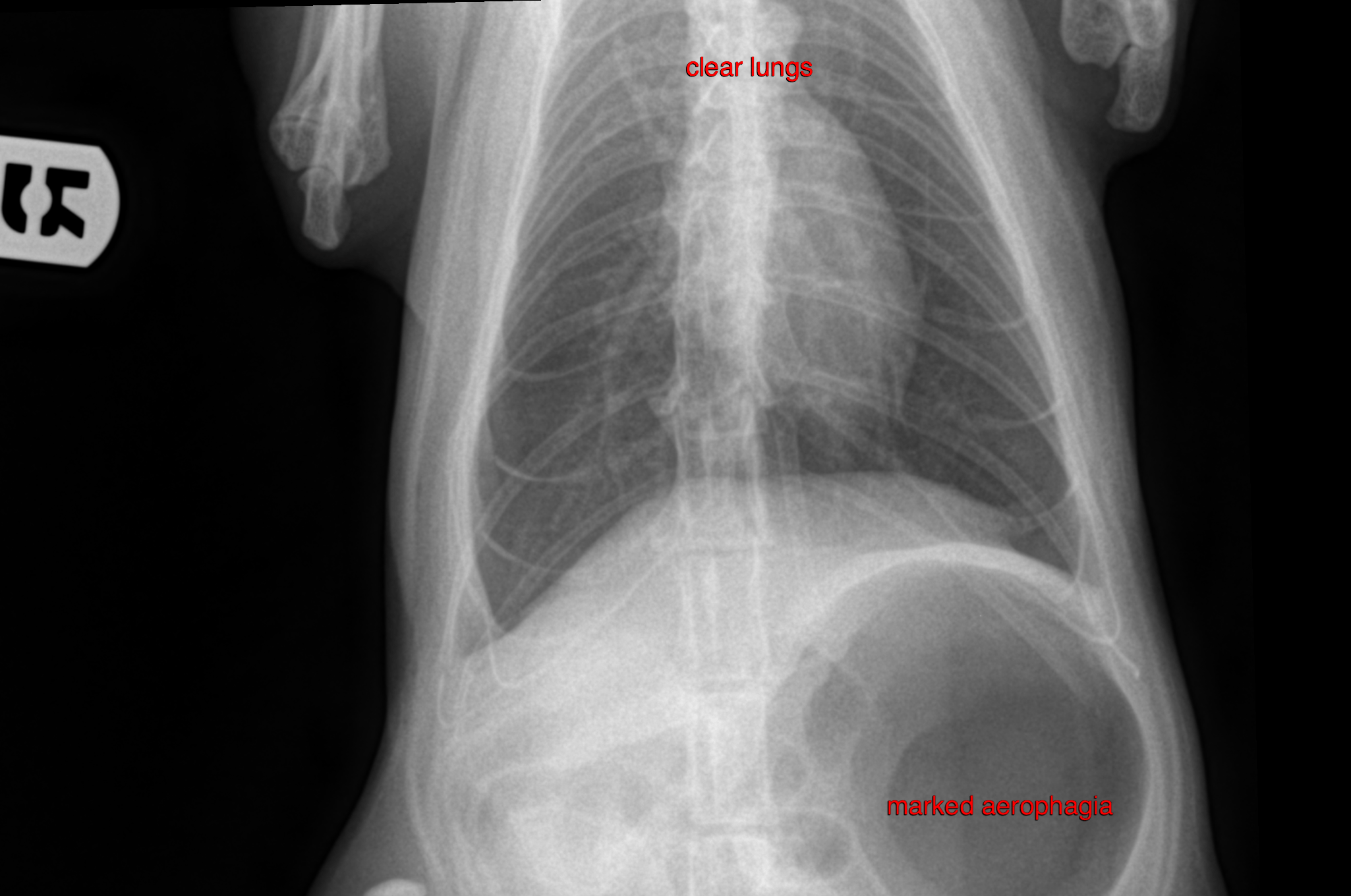 RAD - Microcardia and underperfusion of the lung with aerophagia in a ...