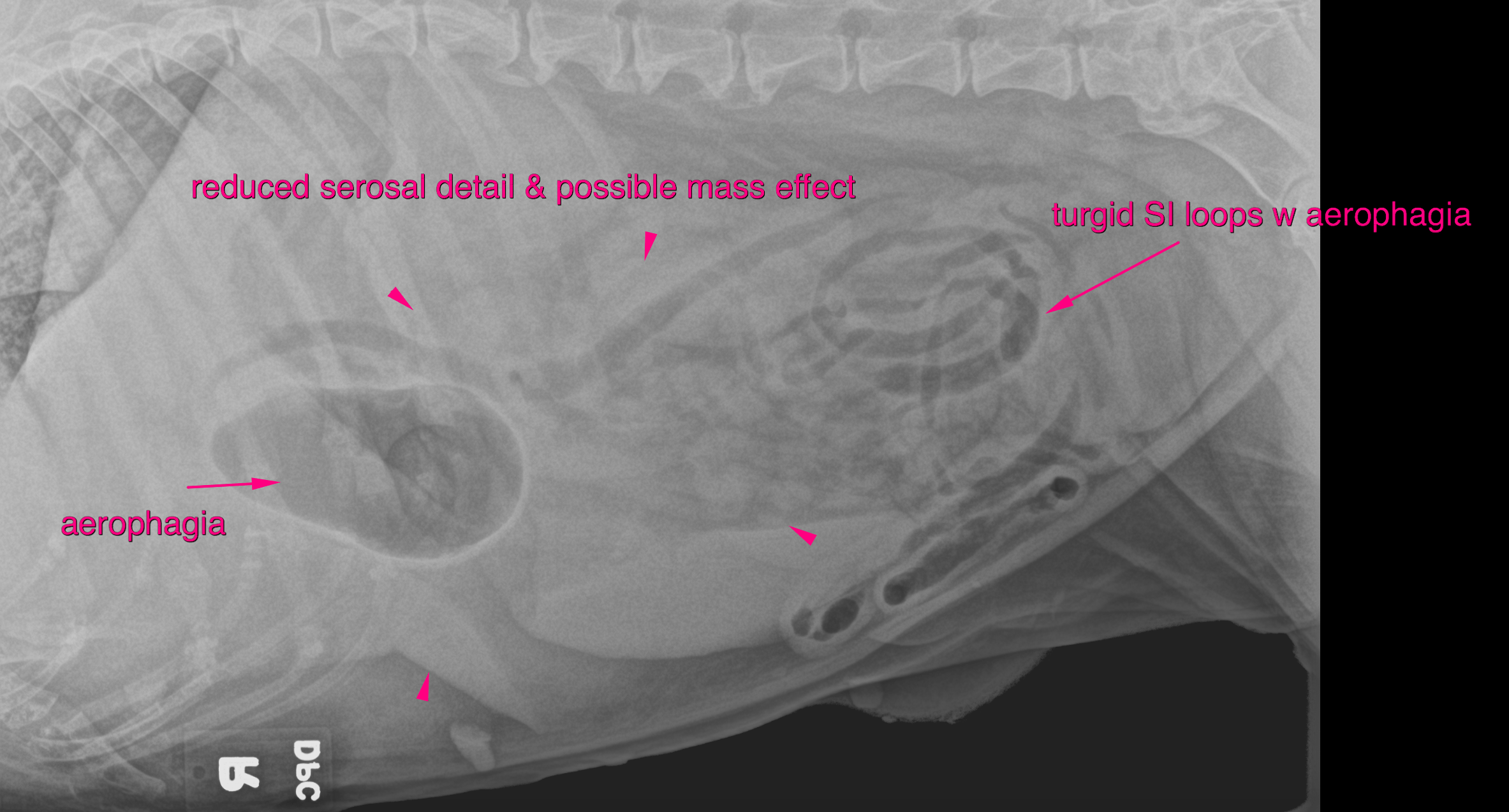 RAD - mid abdominal mass effect with likely mesenteric pathology in a ...
