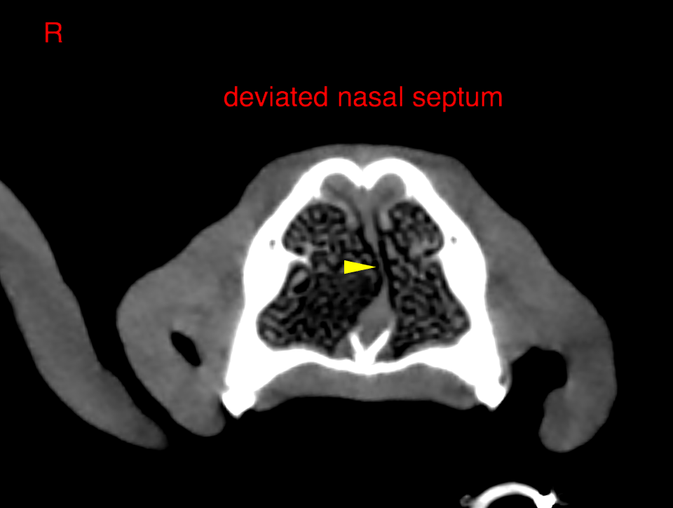 CT - Mild acute viral or parasitic rhinitis in a 6 year old FS ...