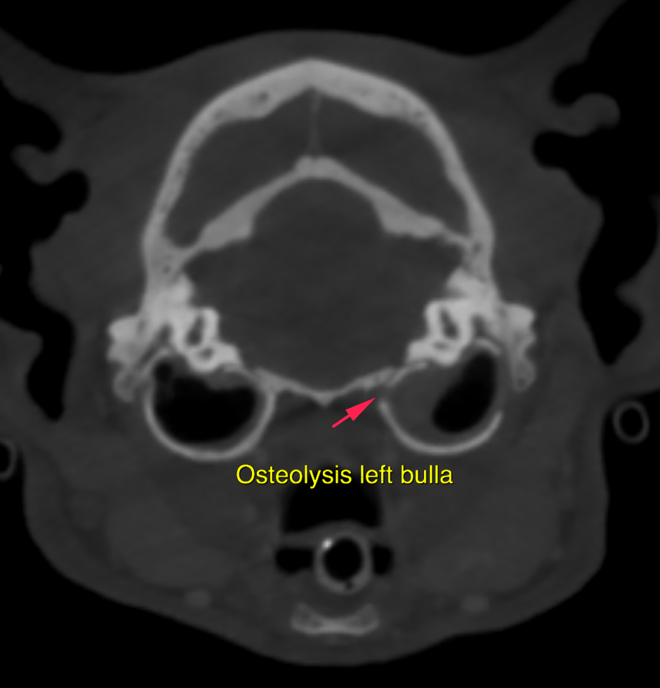 CT - Chronic destructive rhinitis and secondary chronic otitis media in ...