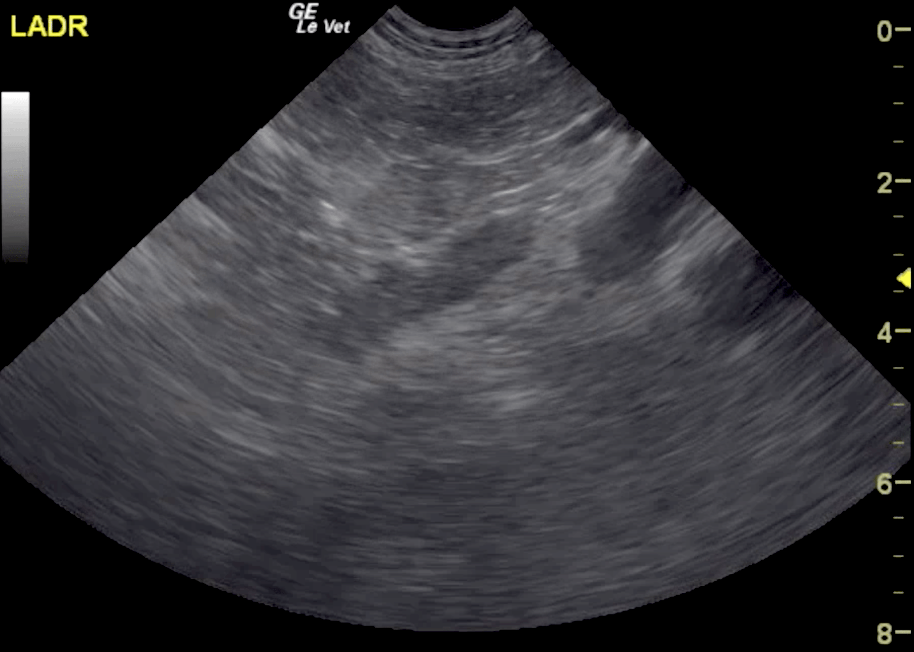 Right Adrenal Mass With Vascular Invasion and Caudal Vena Cava Syndrome ...