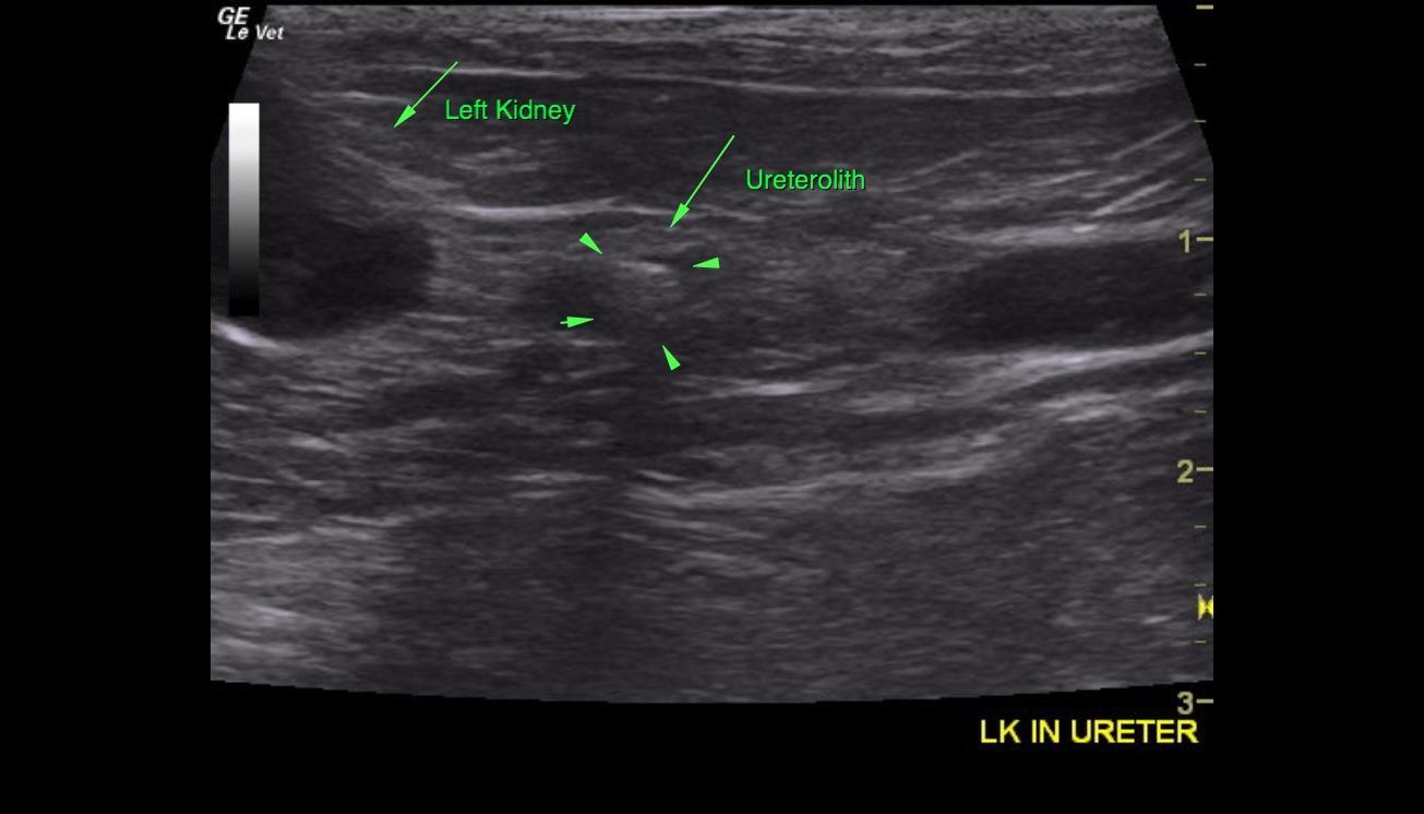 Bilateral Ureterolithiasis and Hydronephrosis in a 10-Year-Old Female ...