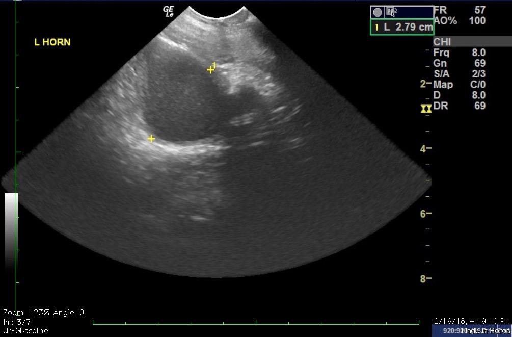 Left horn pyometra with cystic left ovary in a 2 year old presumed ...