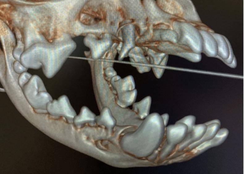 Persistent Deciduous Teeth, Unerupted Permanent Teeth, Dentigerous Cyst ...