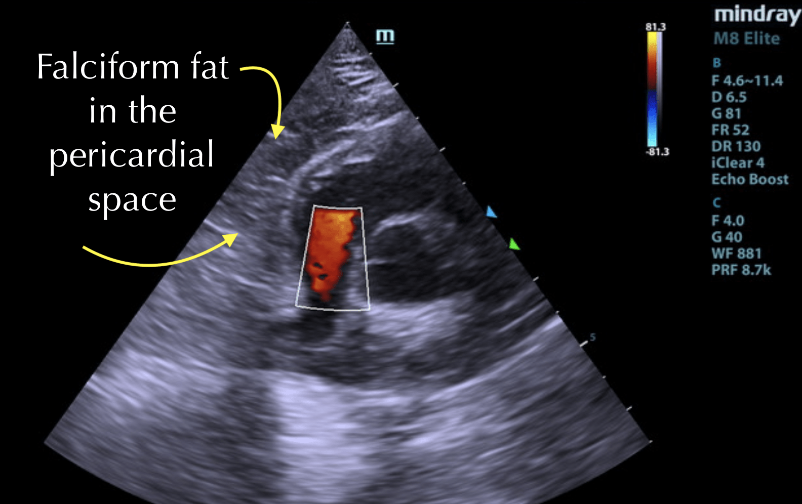 Hemangioma in a 10-year old MN DSH Cat: Our Case Of the Month November ...