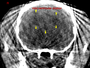 CT - Periodontal disease and oronasal fistula with periodontitis in a ...
