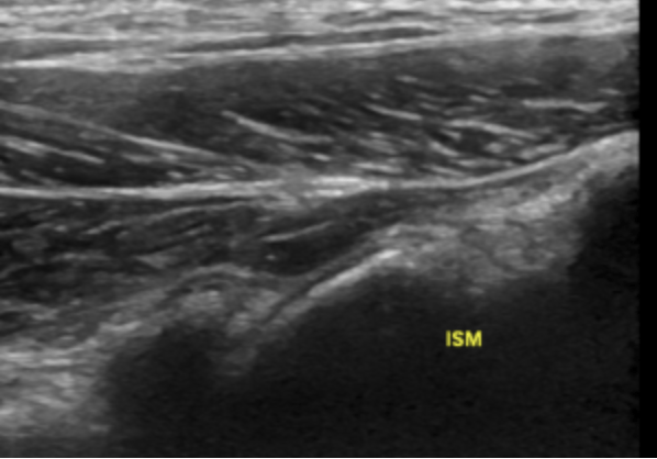 ORTHO - Normal shoulder joint in a 2 year old FS Labrador cross with ...