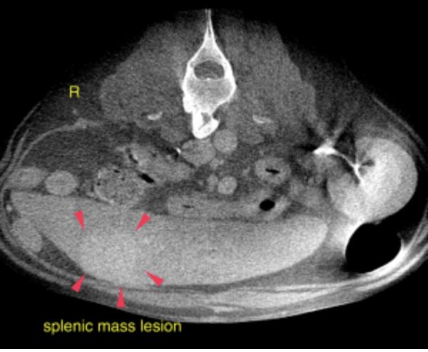 CT -Gastric foreign body, splenic mass and hip dysplasia in a 10 year ...
