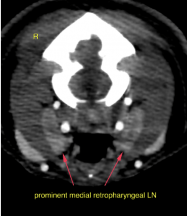 CT - Chronic rhinitis with mild destruction of nasal turbinates and ...