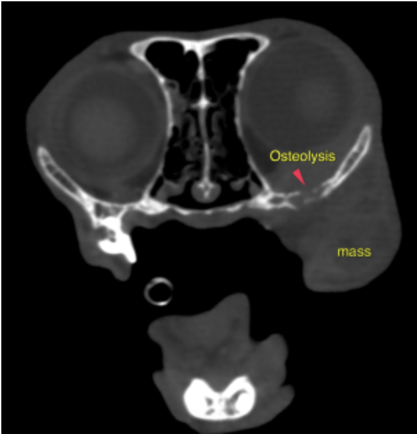 CT - Primary soft tissue neoplasia in the buccal/labial region with ...
